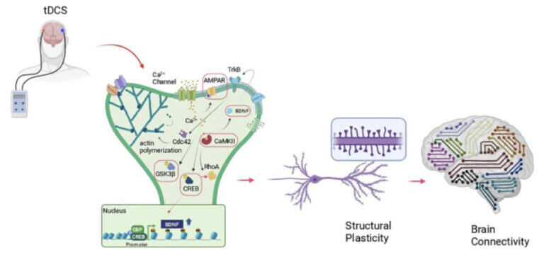 【精神科専門医が解説】tDCS、2025年最新の知見。TMSとの違いは？